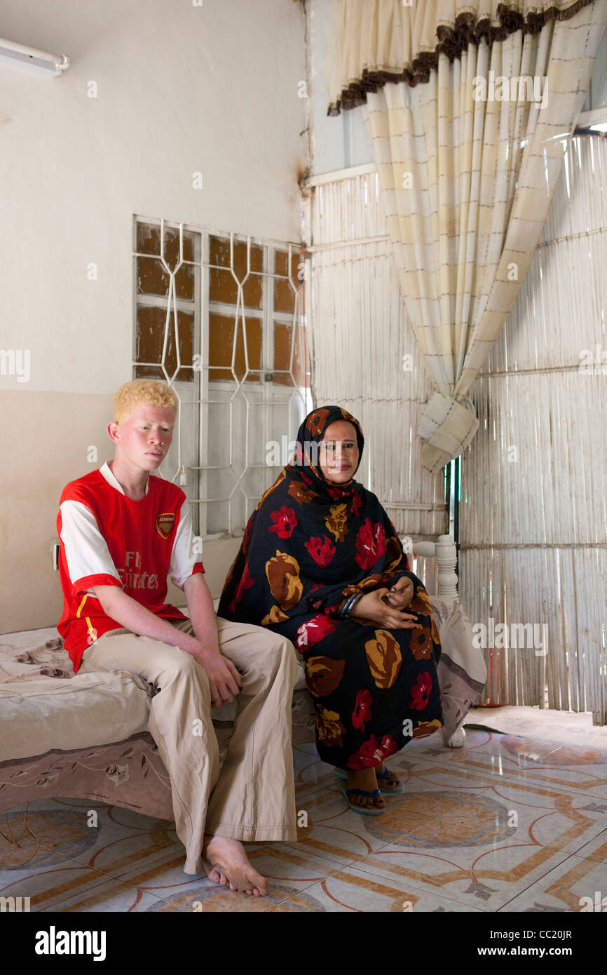Albinism hi-res stock photography and images - Alamy