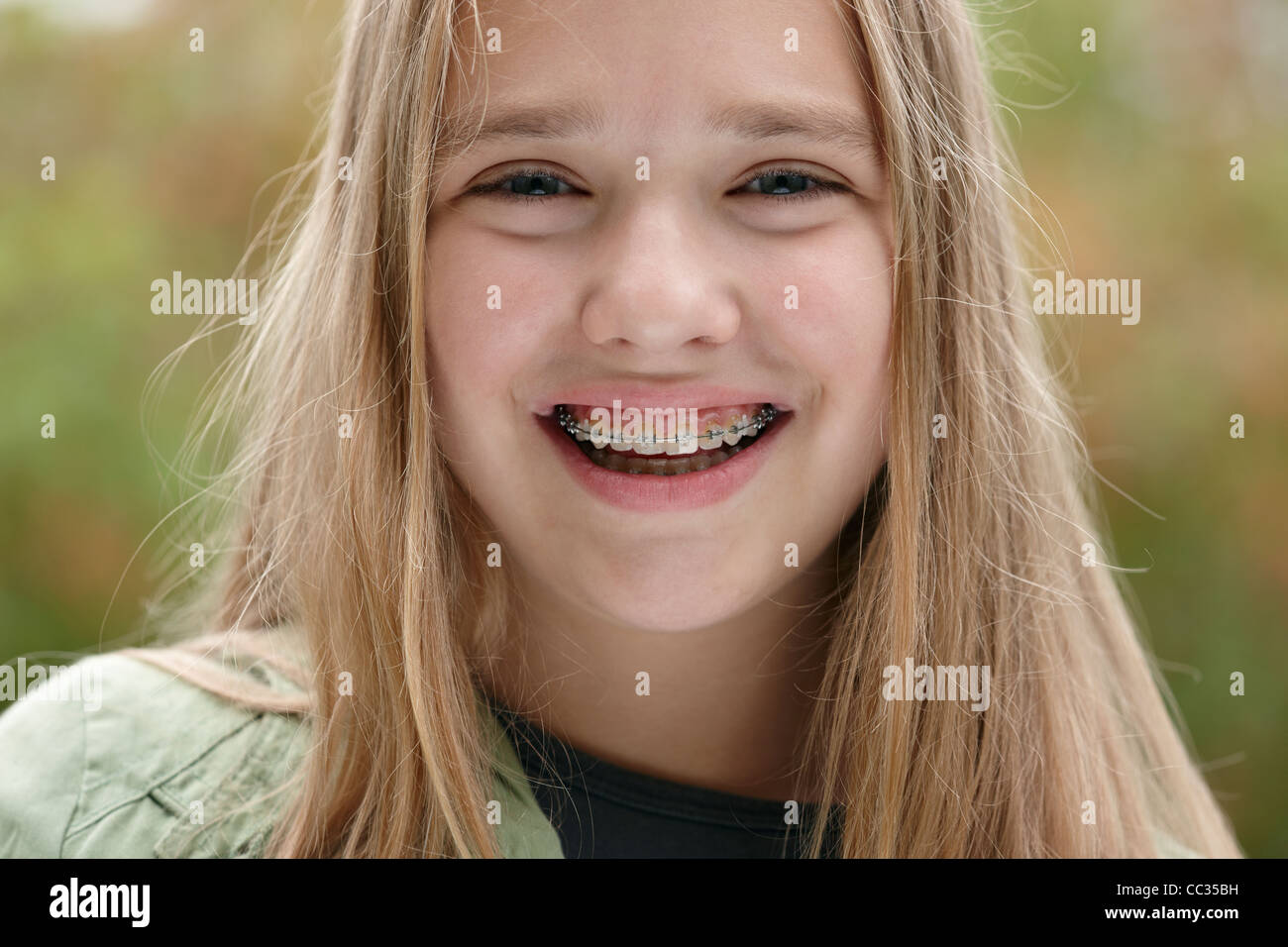 Pretty girl dental braces hi-res stock photography and images - Alamy