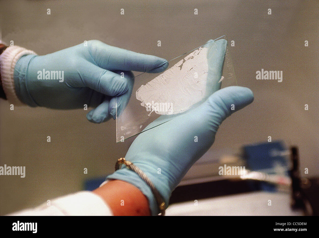 preparing a human brain sample slide Stock Photo - Alamy