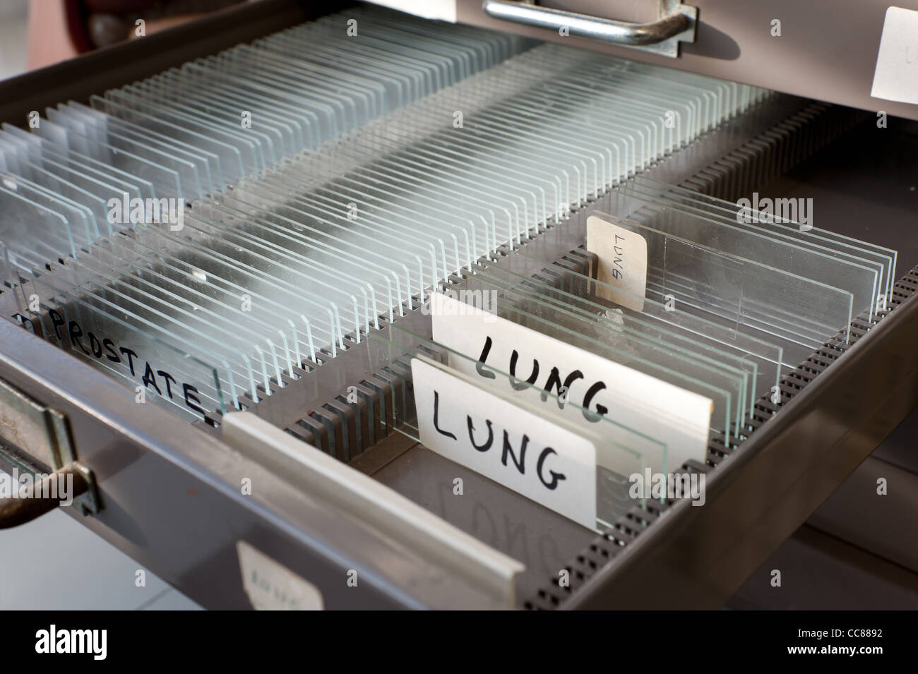 Histology slides hi-res stock photography and images - Alamy