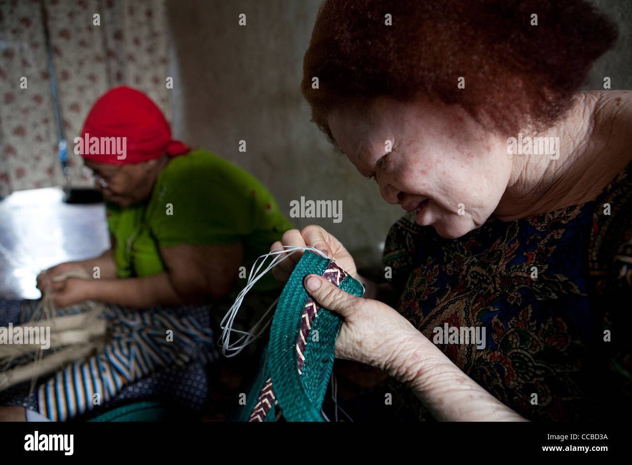 Albinism Human High Resolution Stock Photography and Images - Alamy