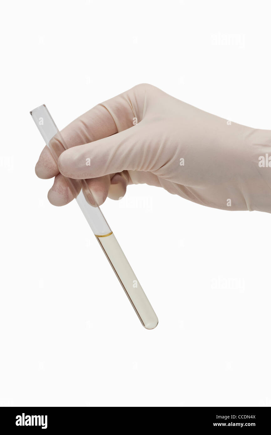 Latex reagenzglas hi-res stock photography and images - Alamy