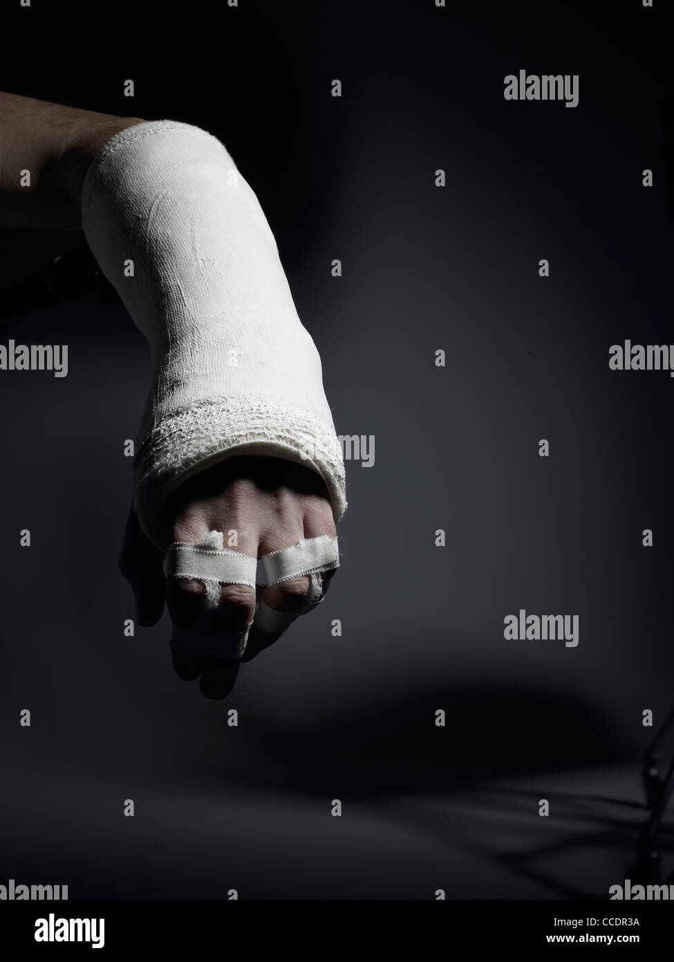 a man with a broken arm and fingers in a plaster cast Stock Photo - Alamy