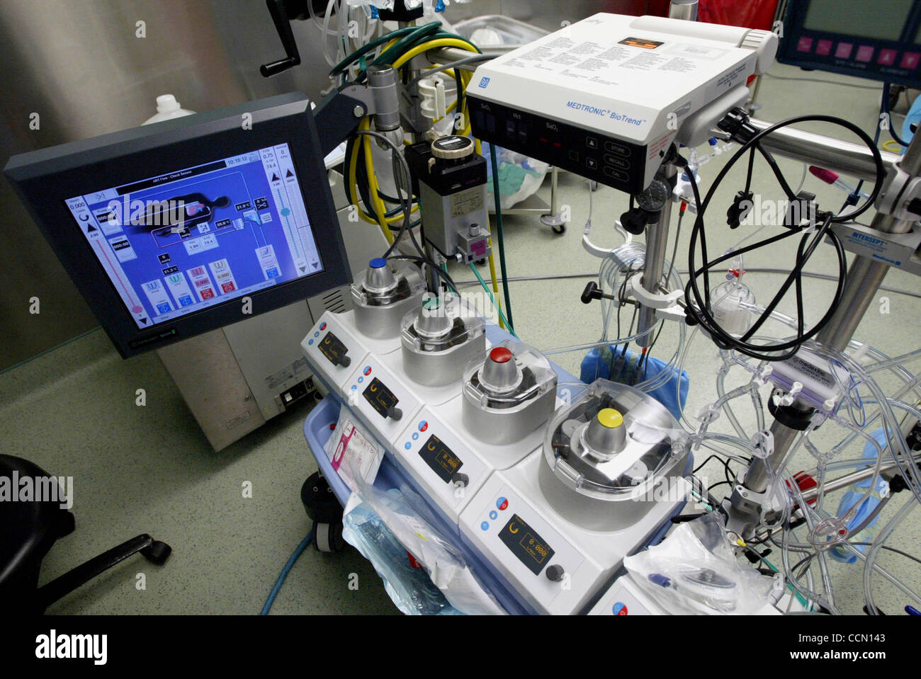 072204 biz heartsurgery9/12--Palm Beach Gardens--A Heart Lung machine ...