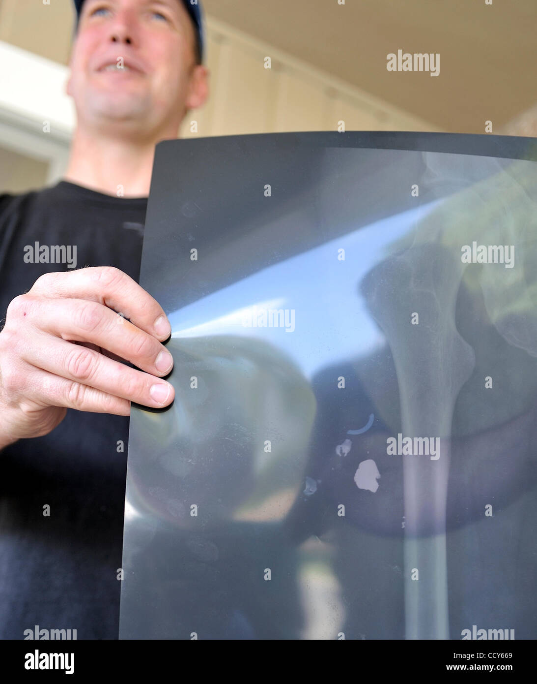 LONG BEACH, CALIF. -- Rich Camp holds an x-ray showing the shrapnel in ...