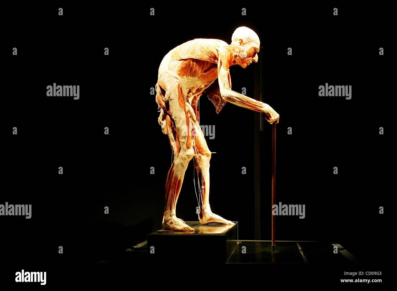 German anatomist gunther von poses hi-res stock photography and images ...