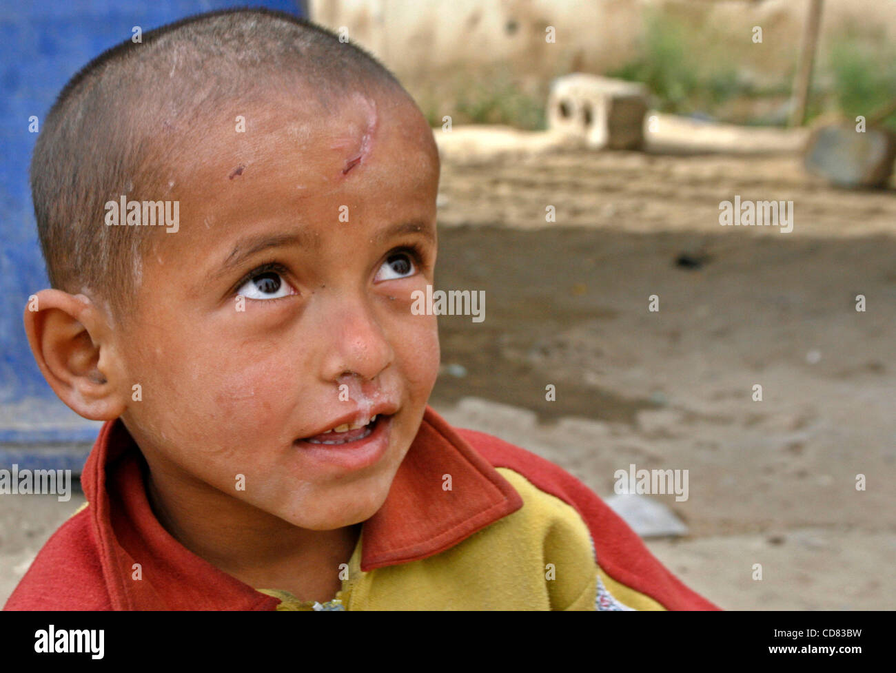 Shrapnel scars hi-res stock photography and images - Alamy