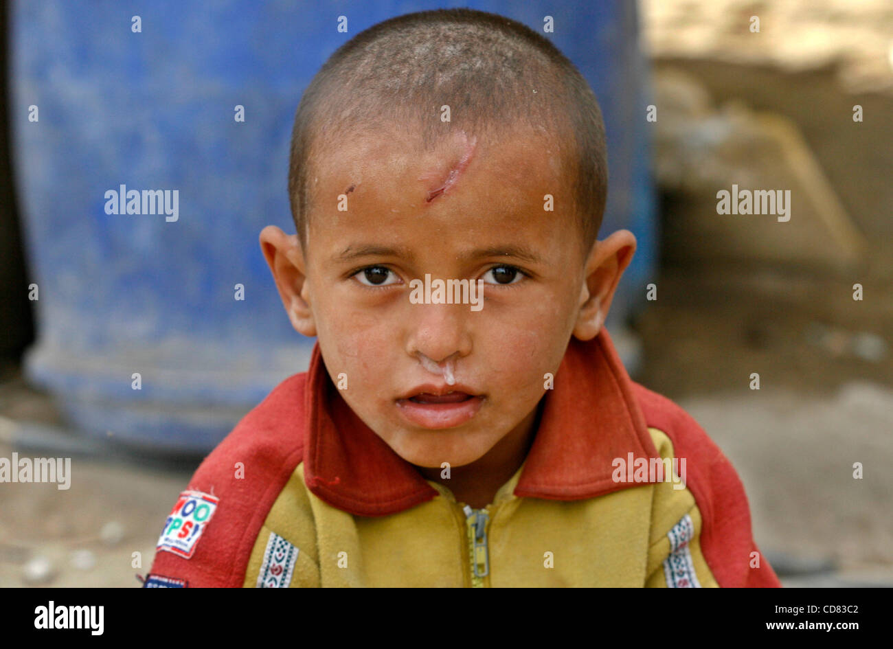 Shrapnel scars hi-res stock photography and images - Alamy