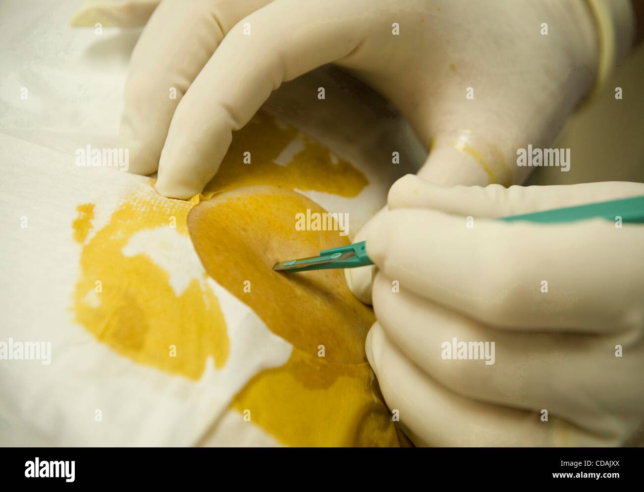 Testosterone replacement therapy hi-res stock photography and images ...