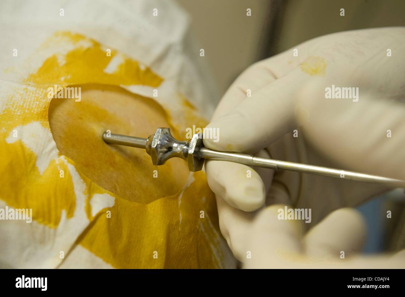 Testosterone replacement therapy hi-res stock photography and images ...