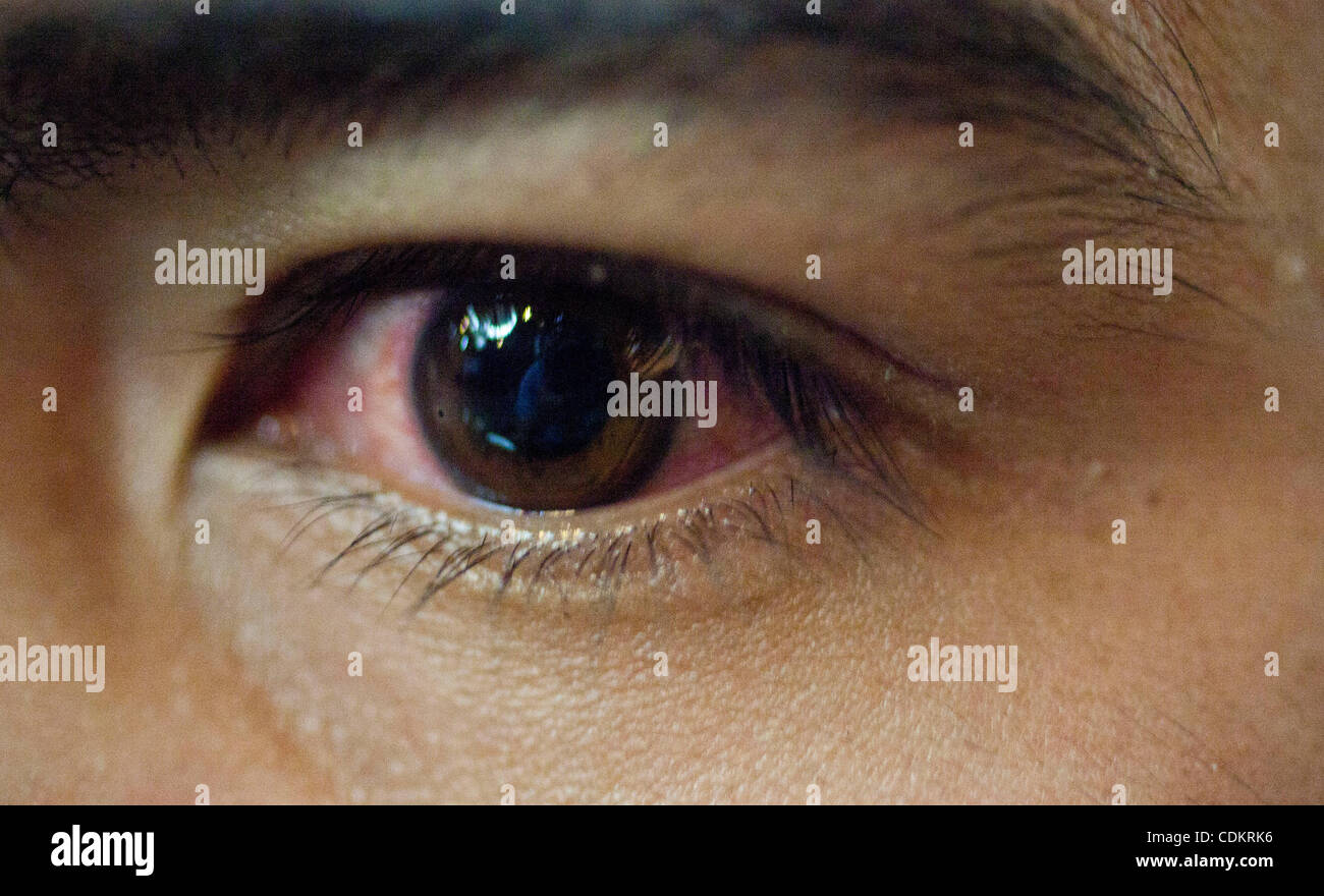 Mar 25, 2011 - Vinh Phuc, Vietnam - PHONG U THUNG became a patient ...