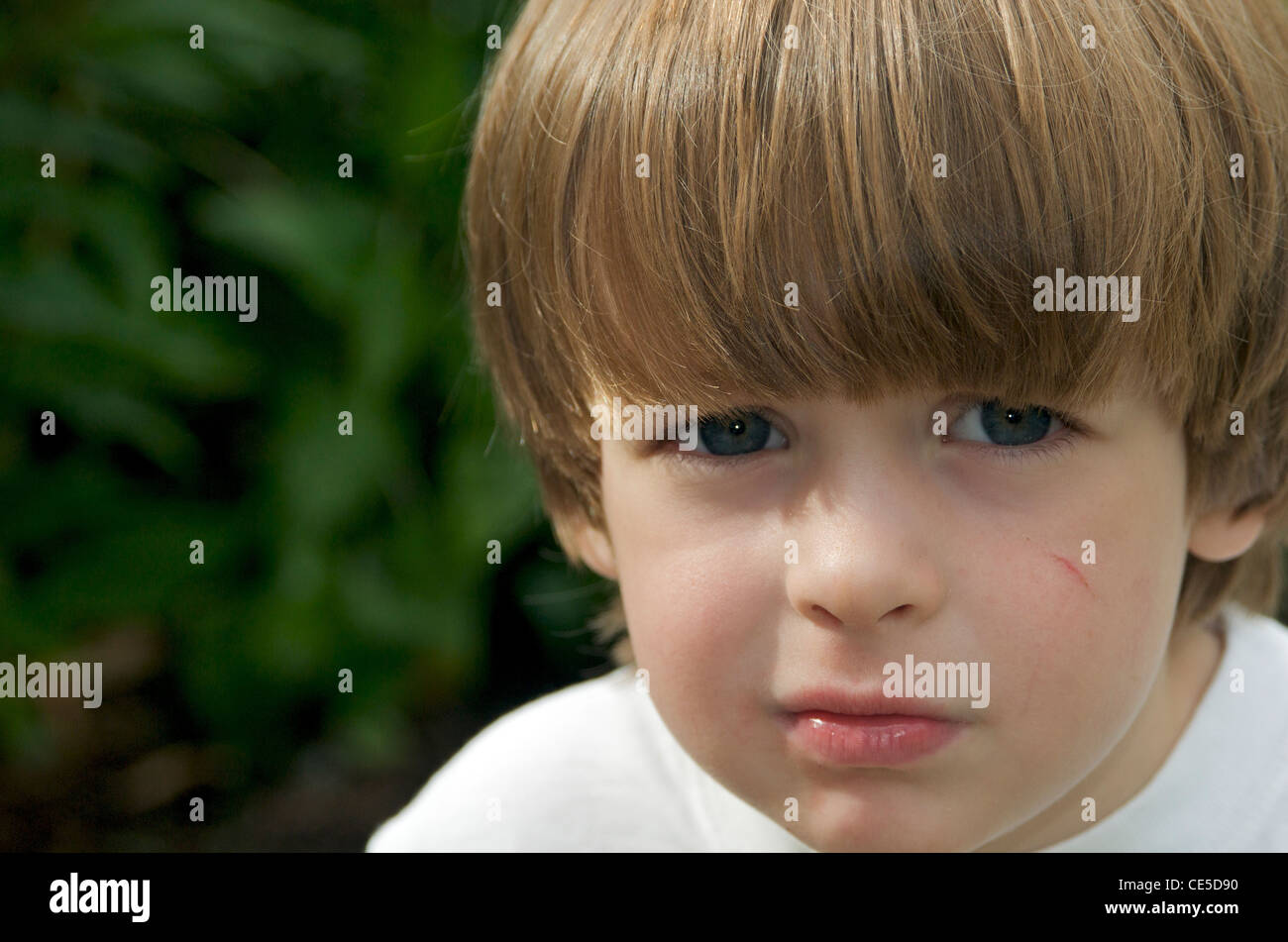 Boy with scratch on cheek Stock Photo - Alamy