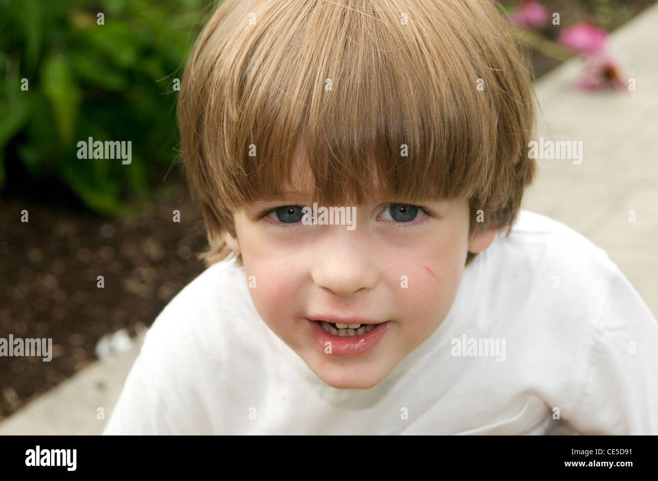 Boy with scratched cheek Stock Photo - Alamy