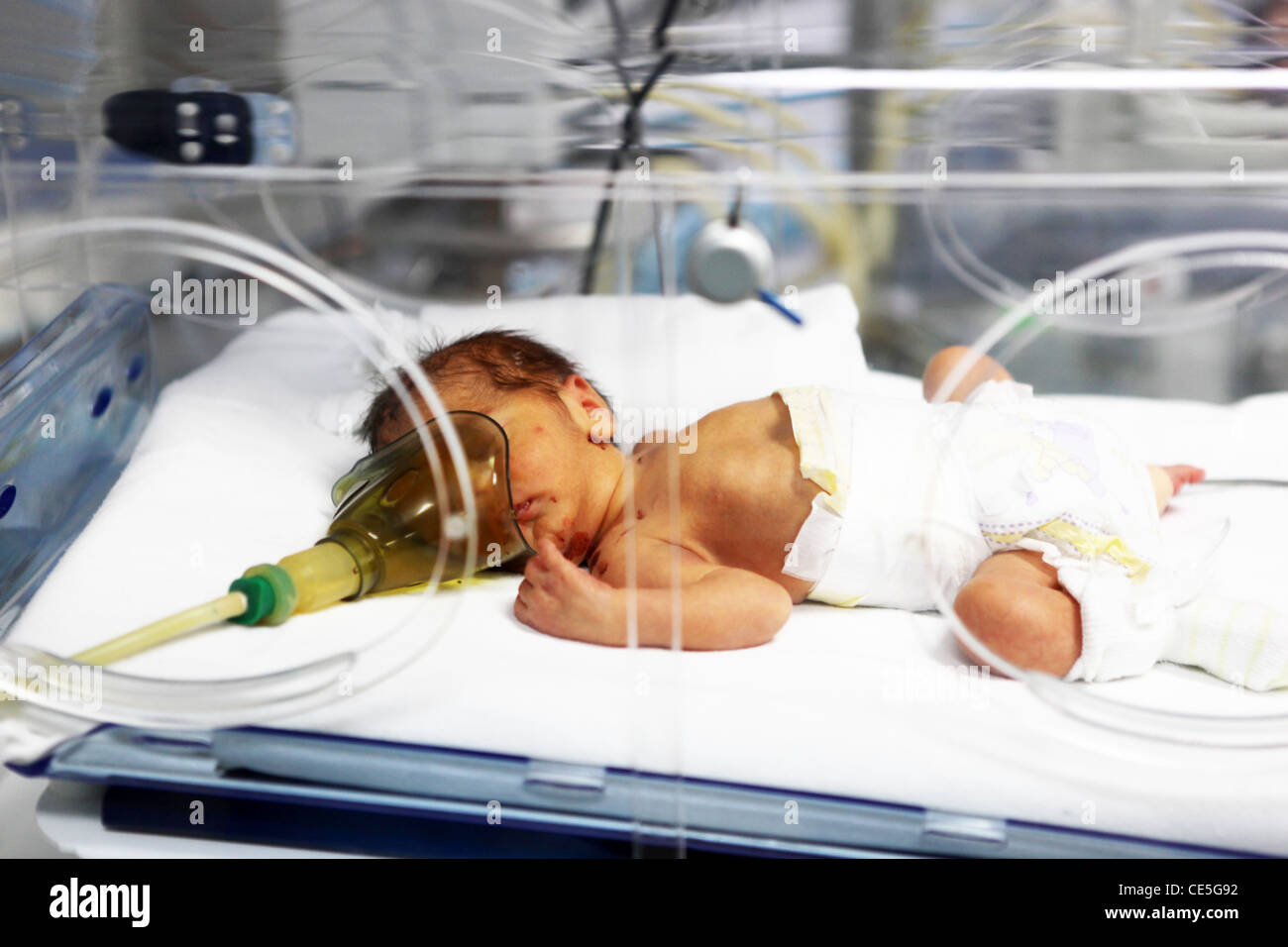 Incubator hospital hi-res stock photography and images - Alamy