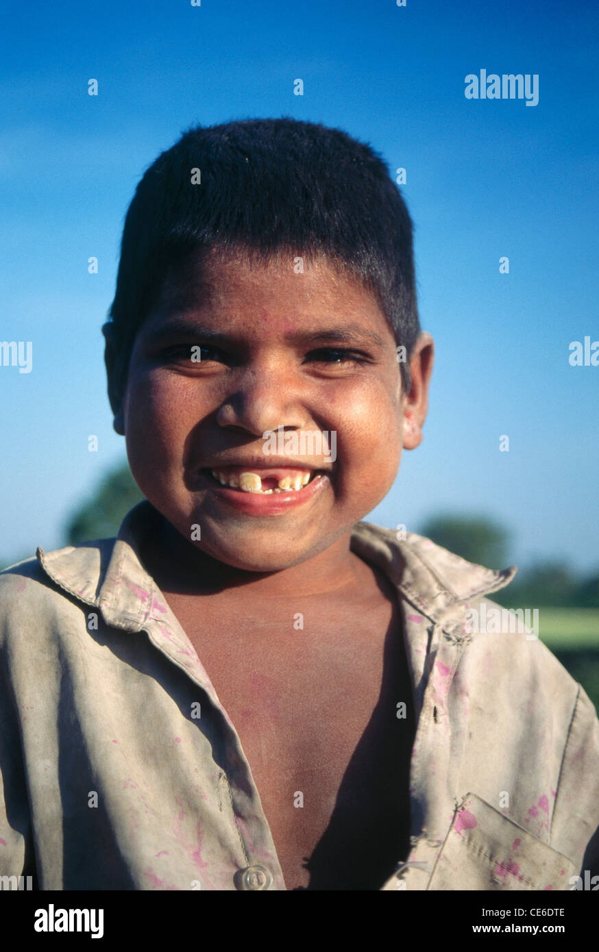 rural boy smiling showing broken teeth Stock Photo - Alamy