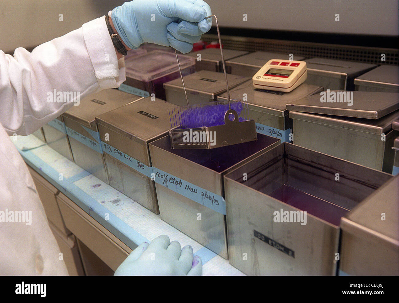 Human brain samples soaking in Nissl stain for use in Dr Victoria ...