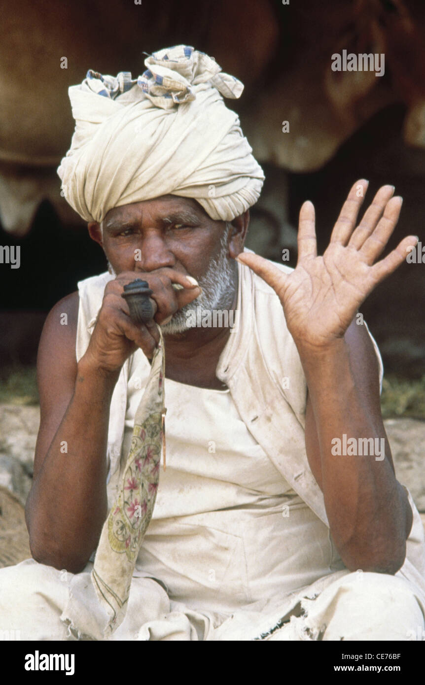 Congenital malformation hi-res stock photography and images - Alamy