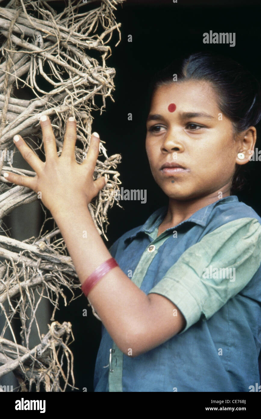 Hexadactyly ; Indian girl with six fingers in hands ; congenital ...