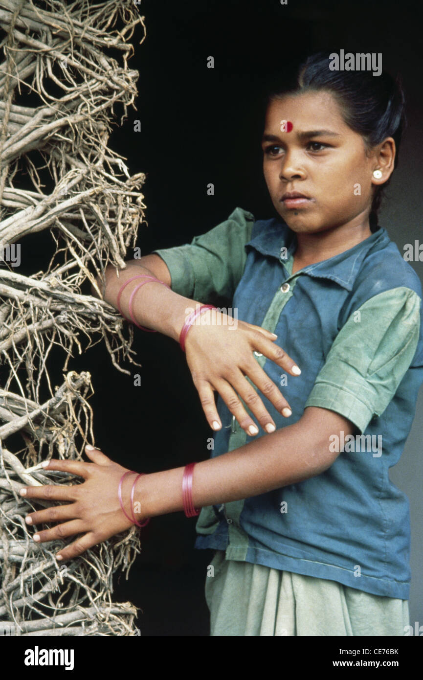 Hexadactyly ; Indian girl with six fingers in hands ; congenital ...