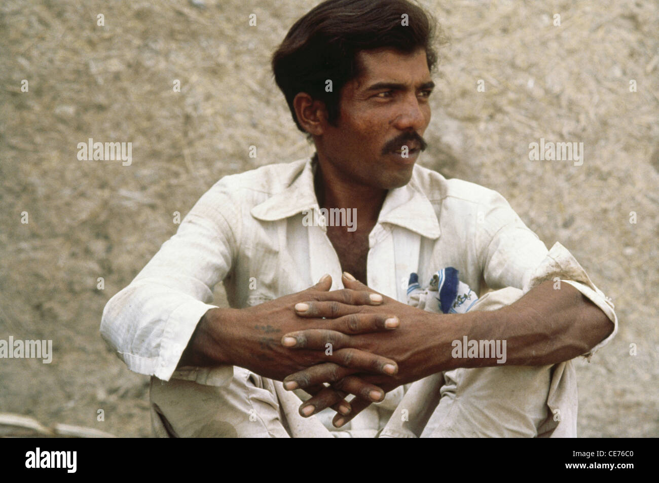 Hexadactyly ; Indian man with six fingers in hands ; congenital ...