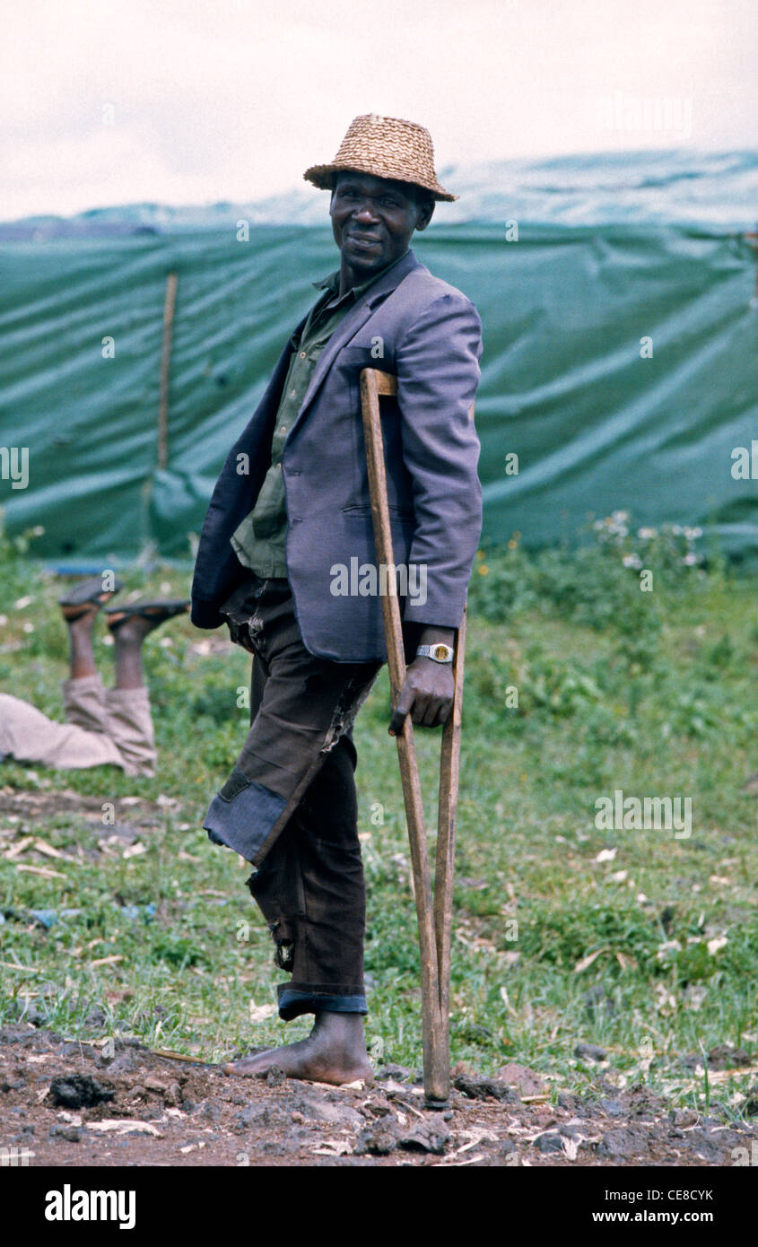 One legged Rwandan Hutu male refugee in United Nations refugee camp in ...