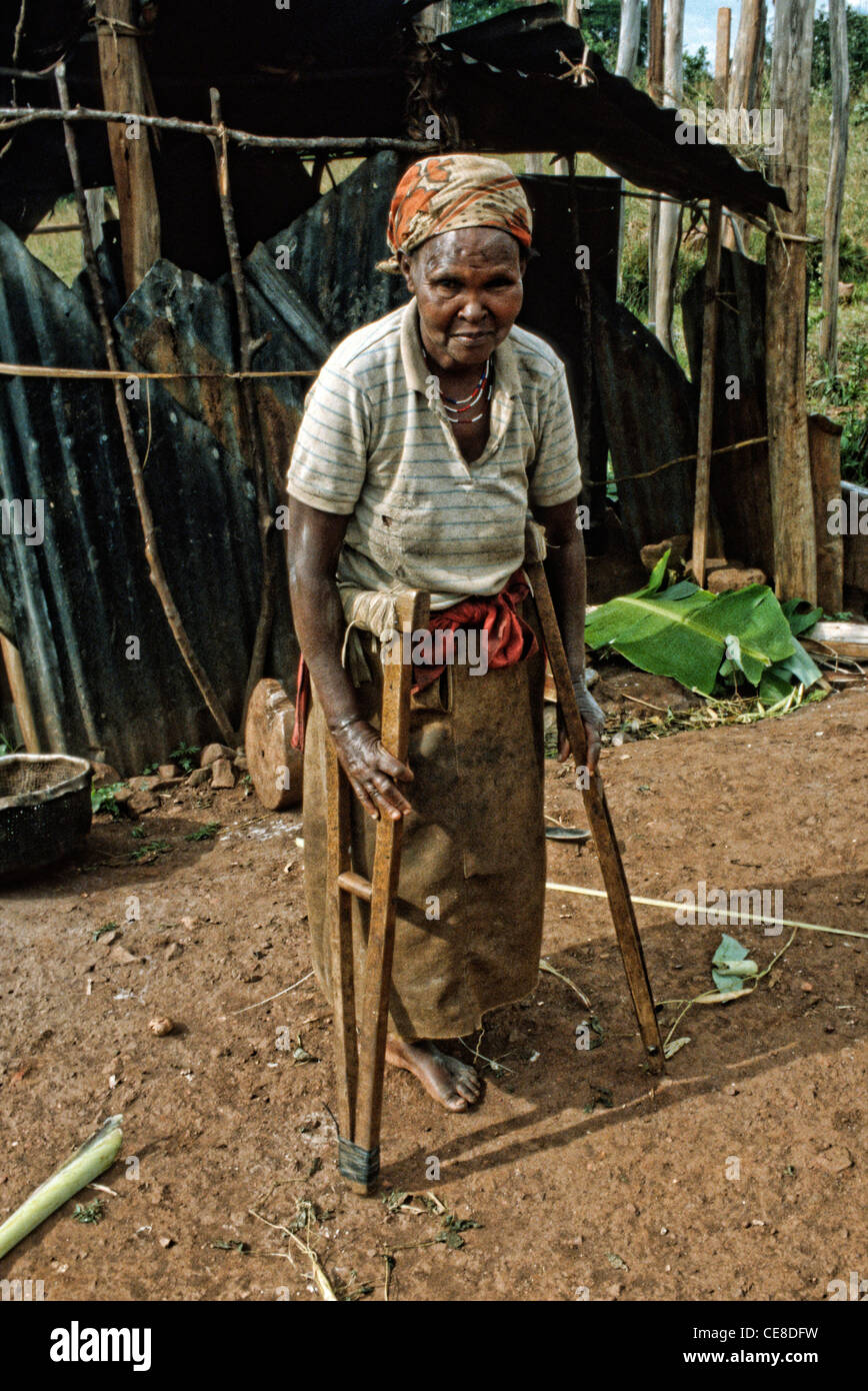 A woman, who lost her leg to diabetes, stands by her house in rural ...