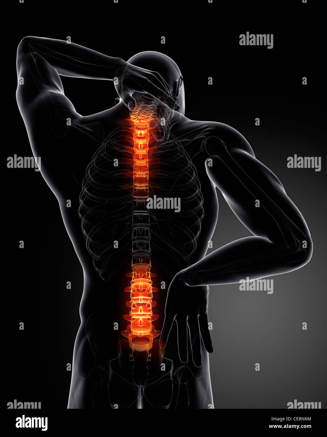 Back pain, conceptual computer artwork Stock Photo - Alamy Back pain, conceptual computer artwork Stock Photo - Alamy