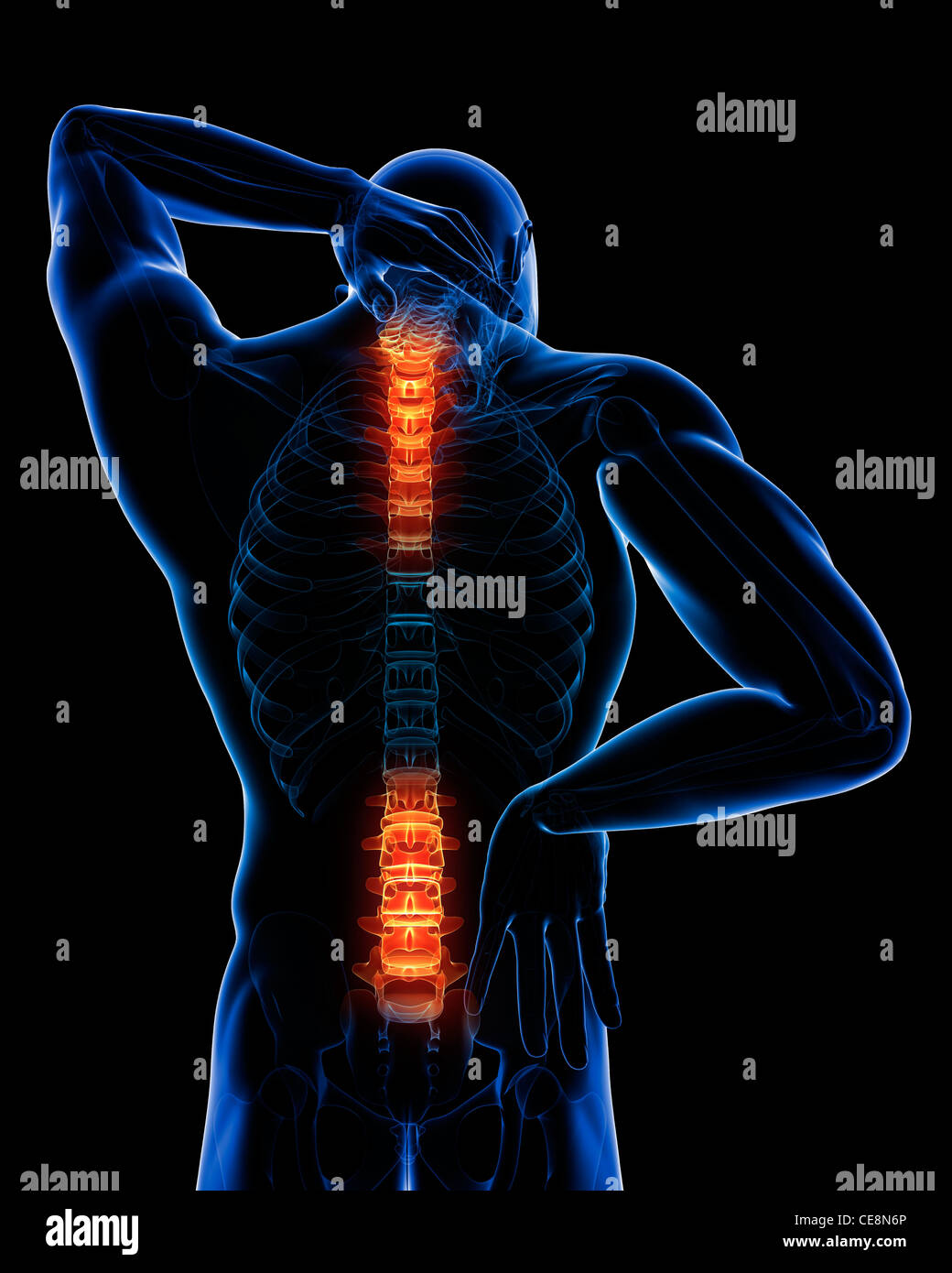 Back pain, conceptual computer artwork Stock Photo - Alamy