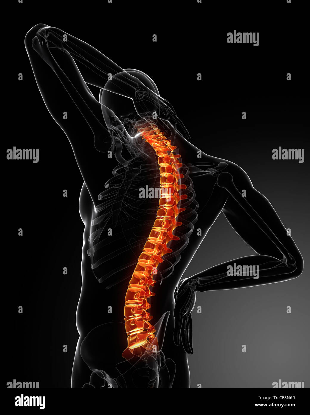 Back pain, conceptual computer artwork Stock Photo - Alamy
