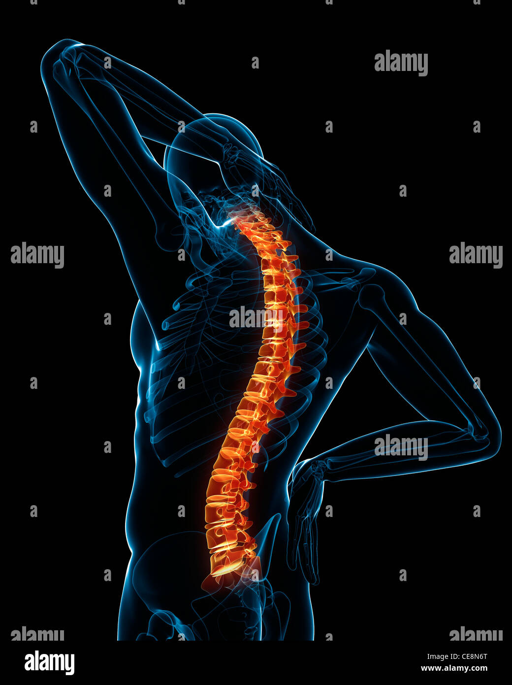 Back pain, conceptual computer artwork Stock Photo - Alamy