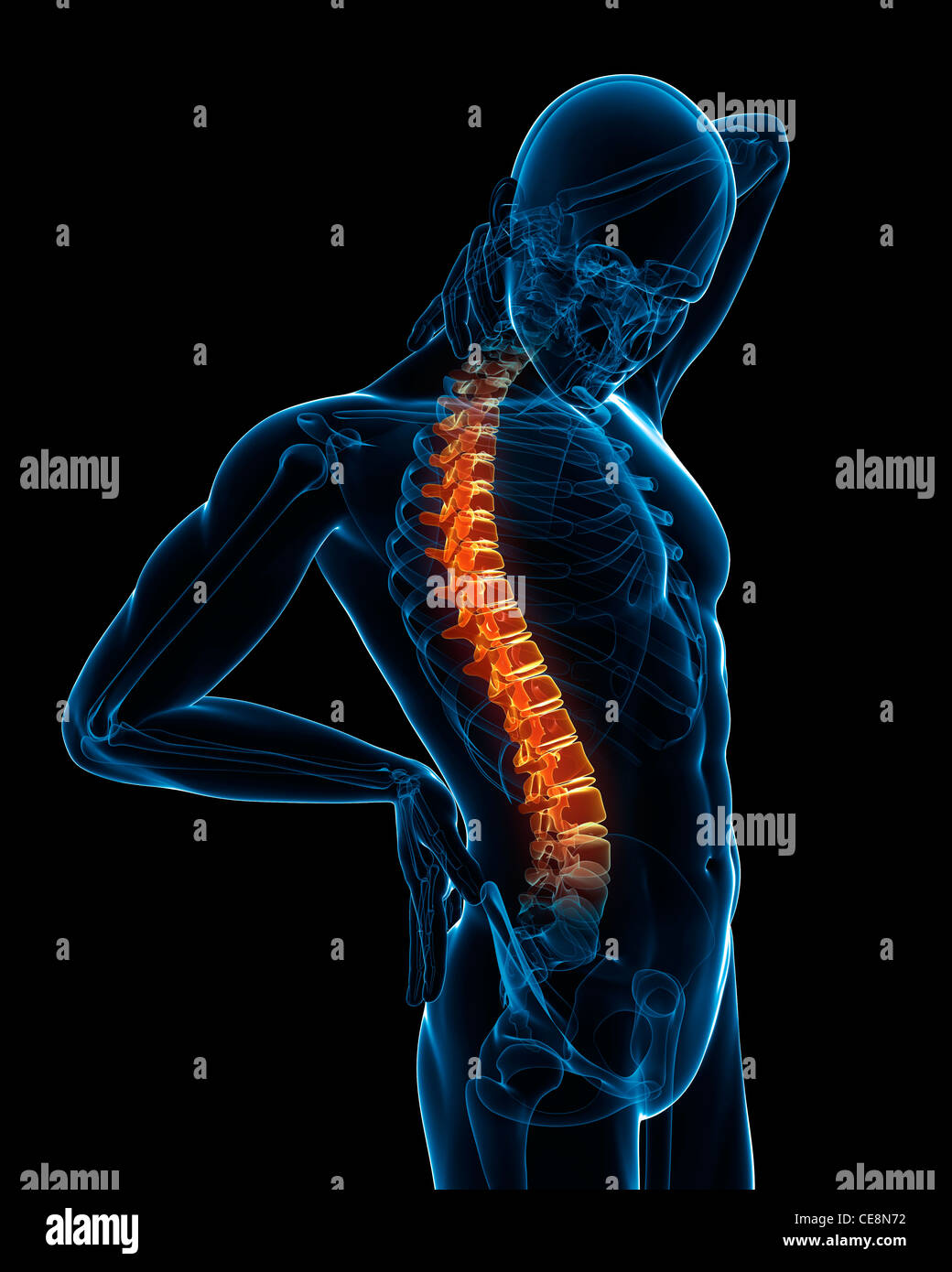 Back pain, conceptual computer artwork Stock Photo - Alamy
