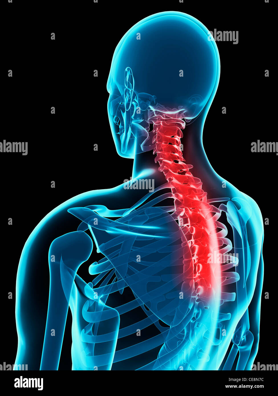Back pain, conceptual computer artwork Stock Photo - Alamy