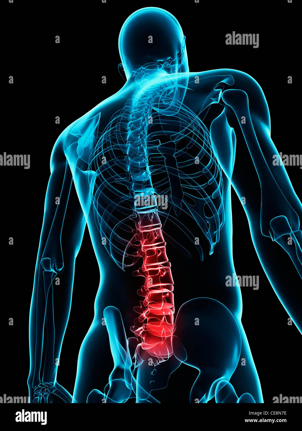 Back pain, conceptual computer artwork Stock Photo - Alamy