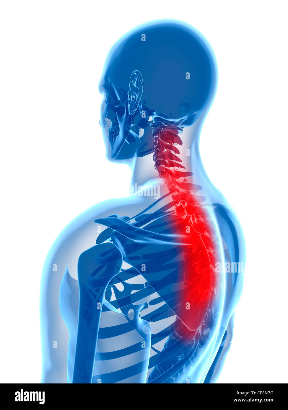 Back pain, conceptual computer artwork Stock Photo - Alamy