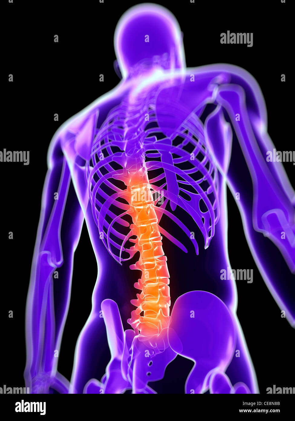 Back pain, conceptual computer artwork Stock Photo - Alamy