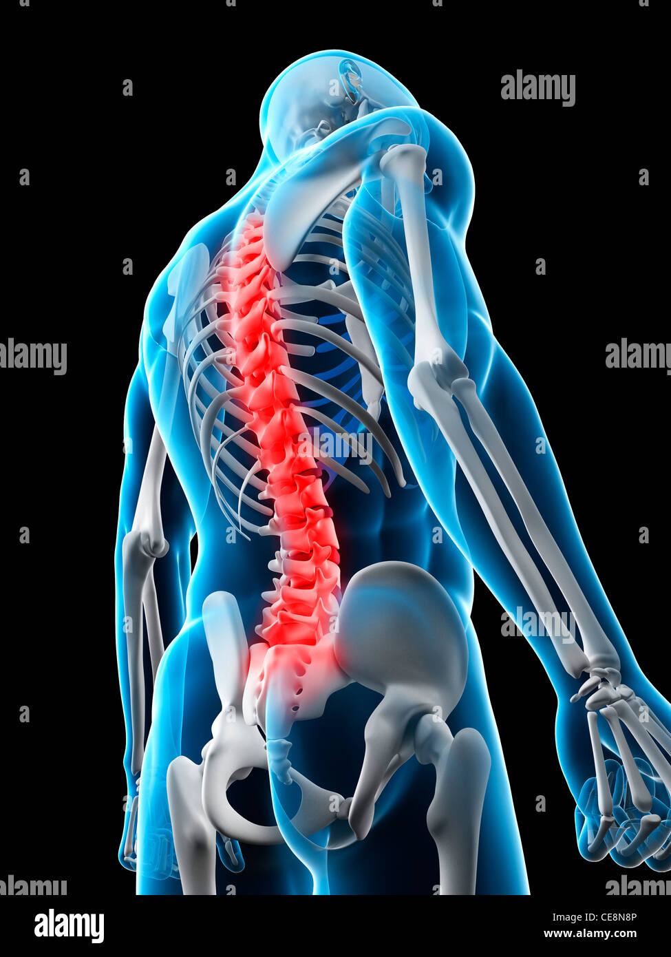 Back pain, conceptual computer artwork Stock Photo - Alamy