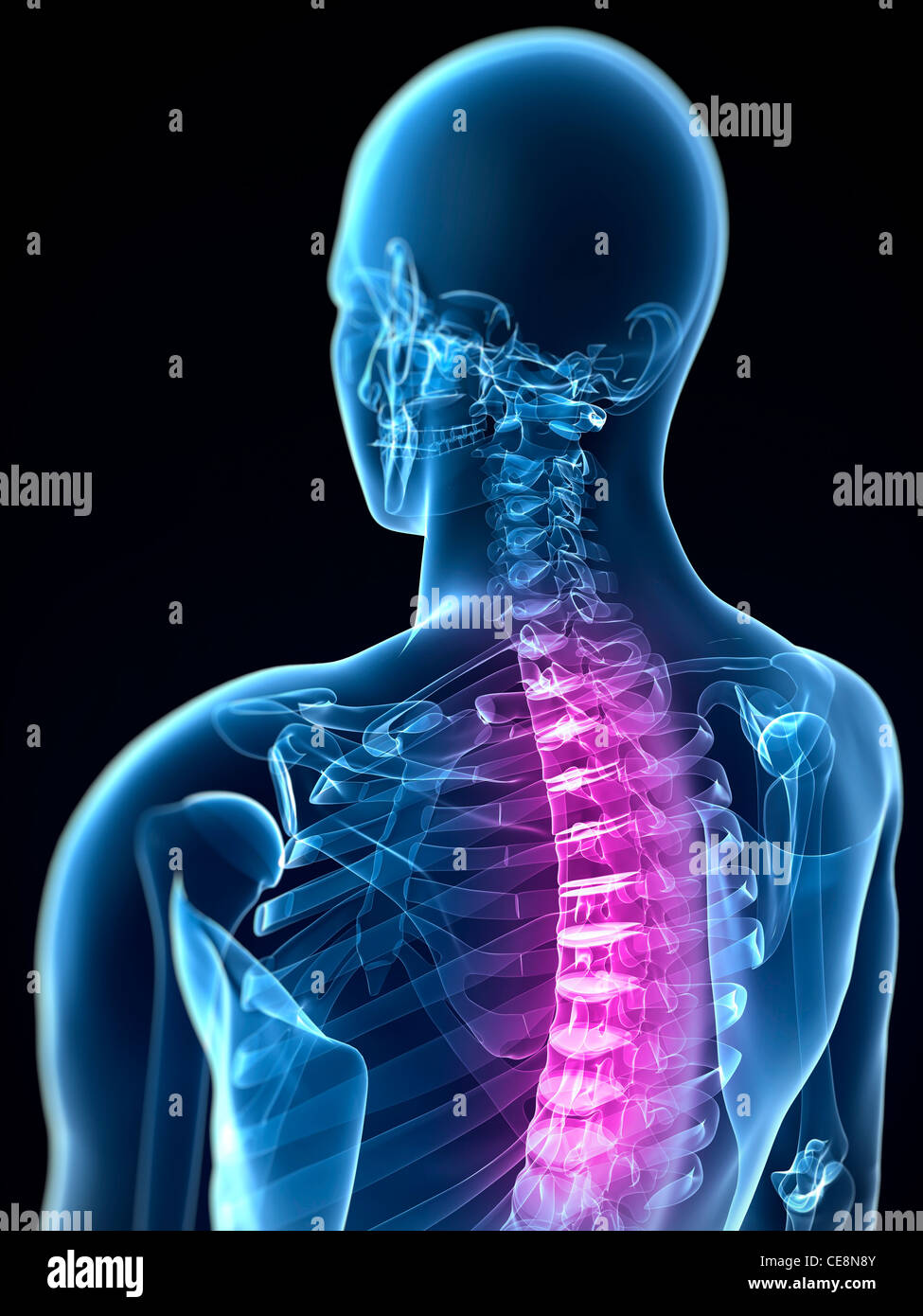 Back pain conceptual computer artwork hi-res stock photography and ...