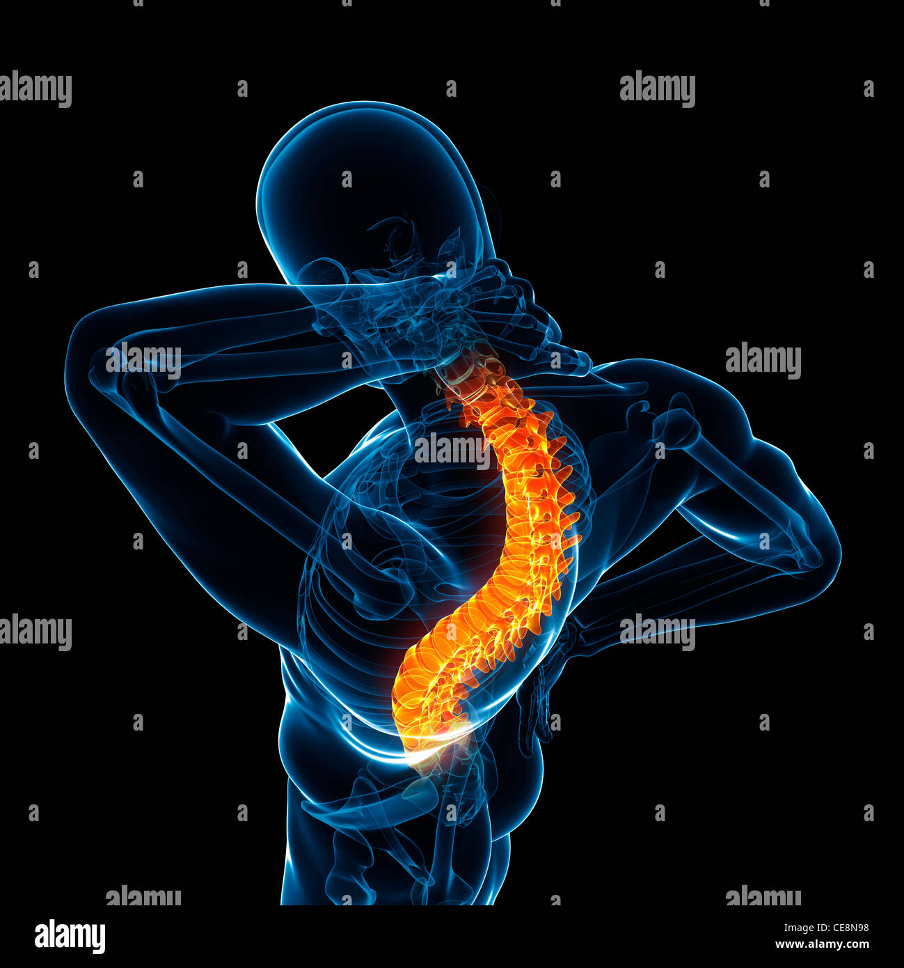 Curved backbone hi-res stock photography and images - Alamy