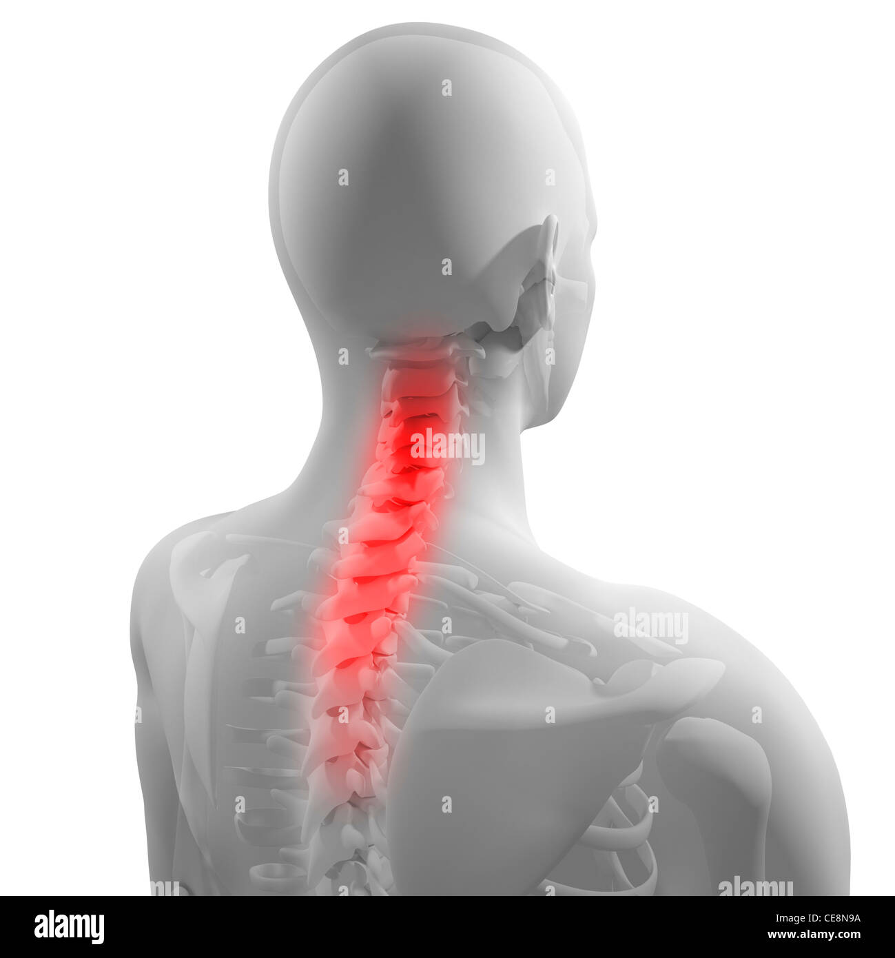 Back pain, conceptual computer artwork Stock Photo - Alamy