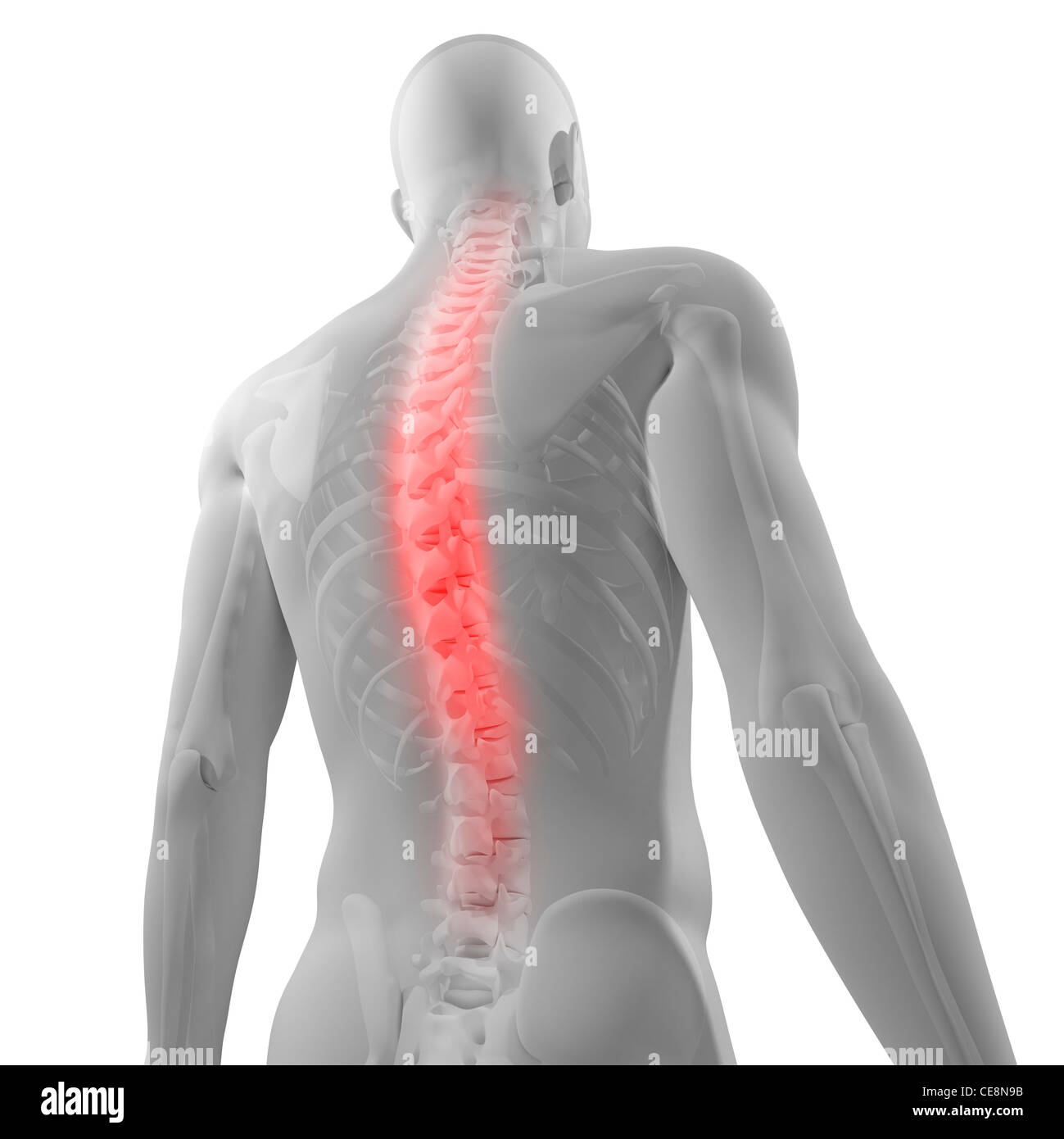 Back pain, conceptual computer artwork Stock Photo - Alamy