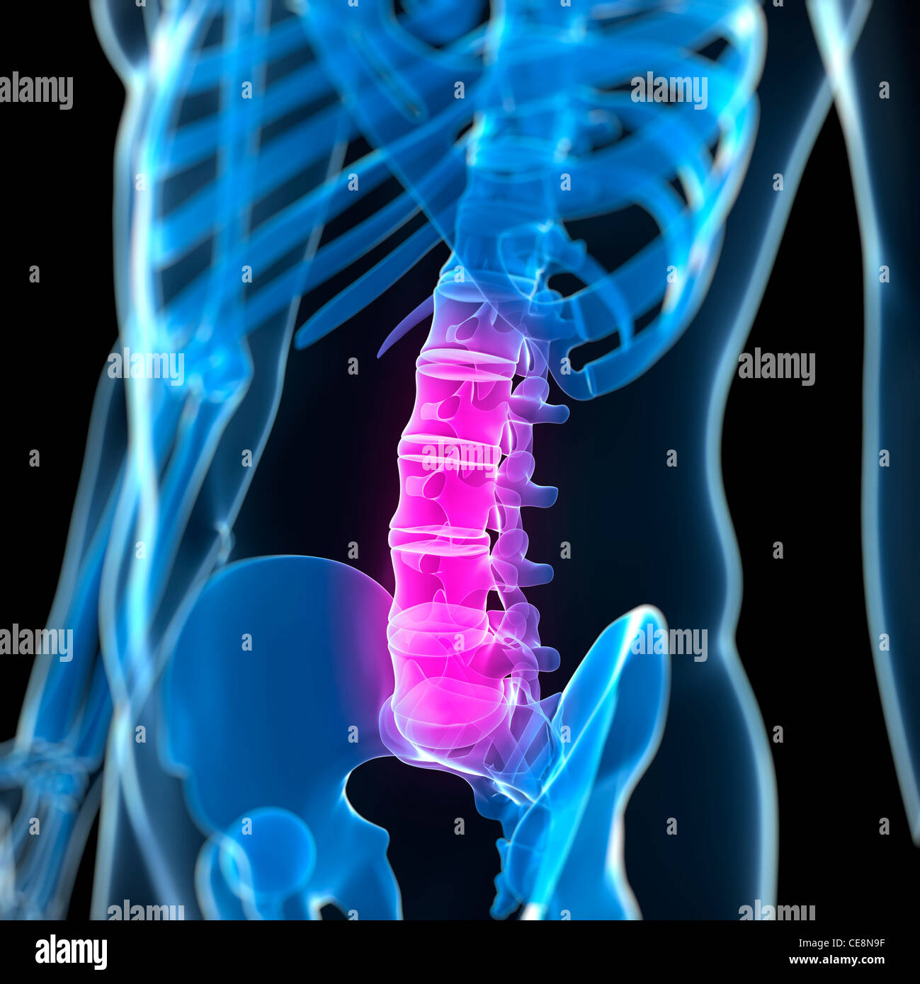 Back pain, conceptual computer artwork Stock Photo - Alamy