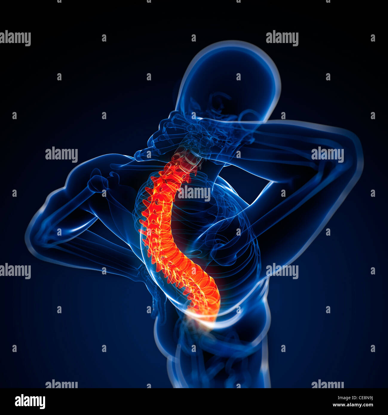 Back pain, conceptual computer artwork Stock Photo - Alamy