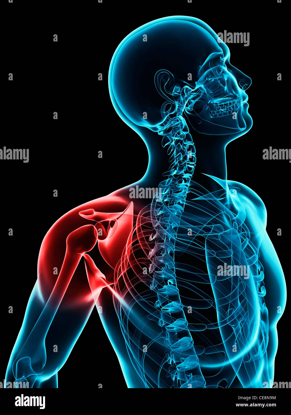 Shoulder pain, conceptual computer artwork Stock Photo - Alamy