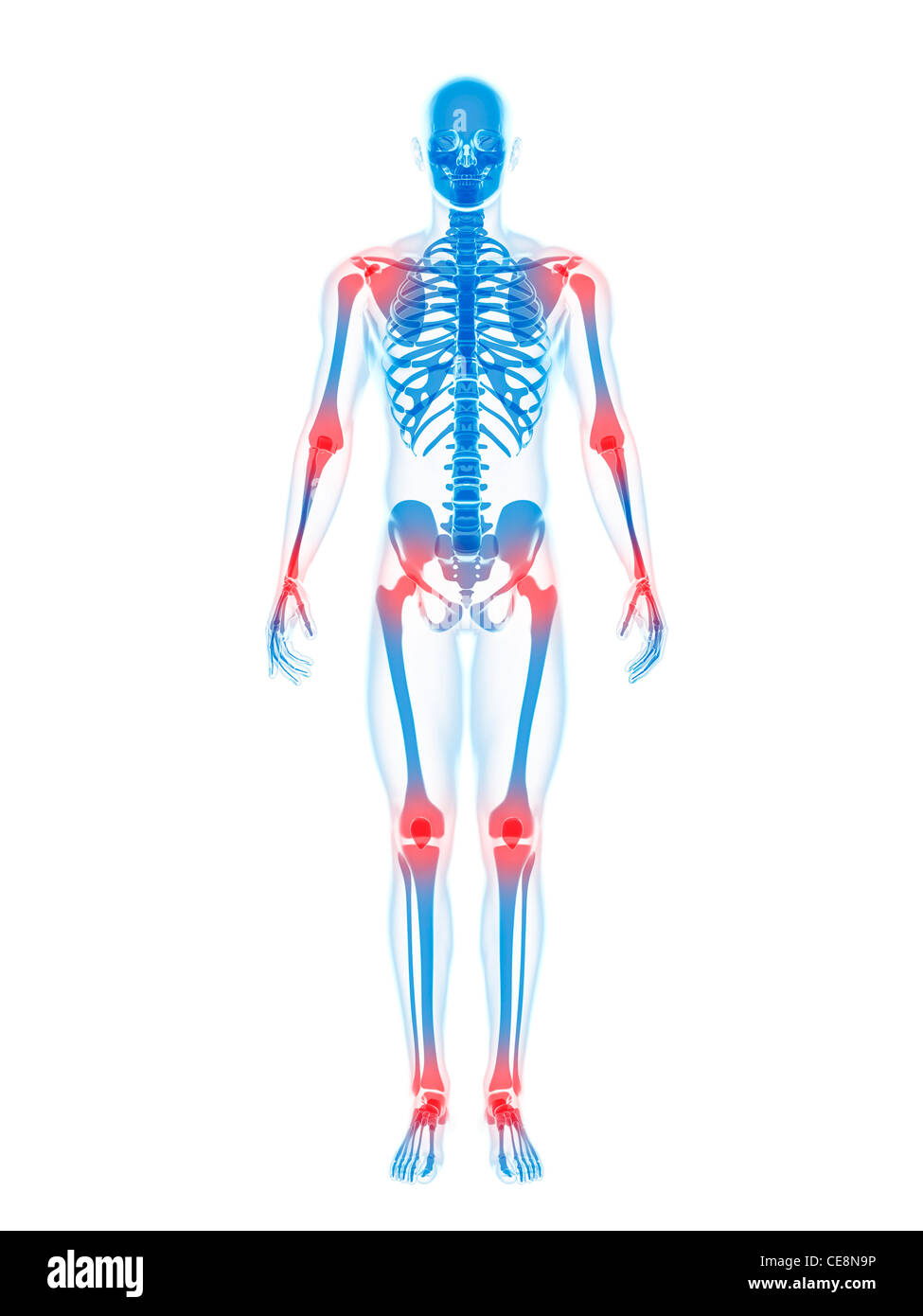 Joint pain, conceptual computer artwork Stock Photo - Alamy