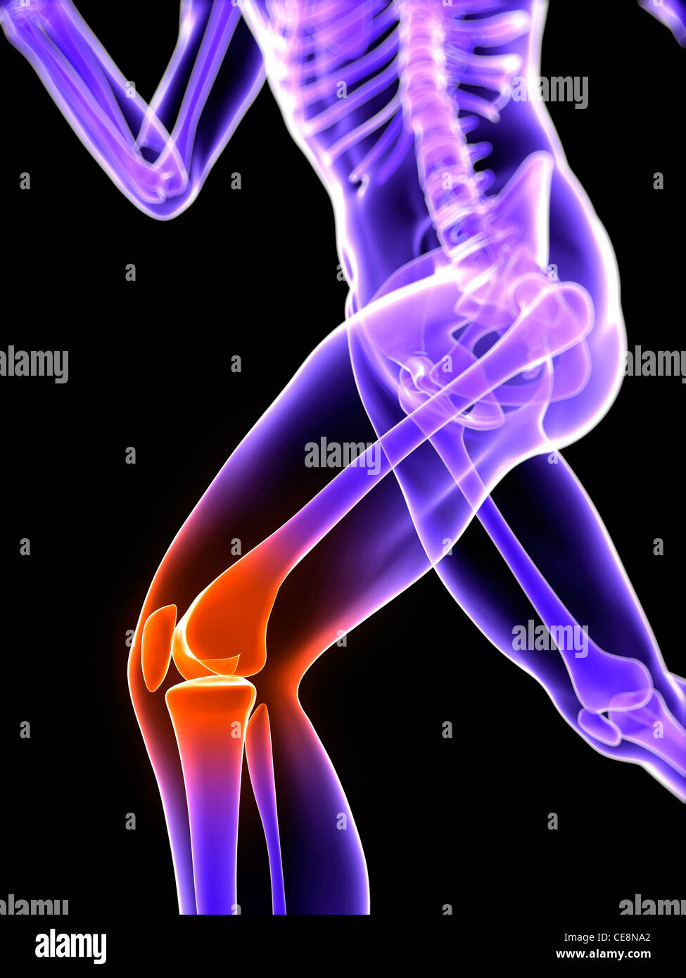 Knee pain, conceptual computer artwork Stock Photo - Alamy