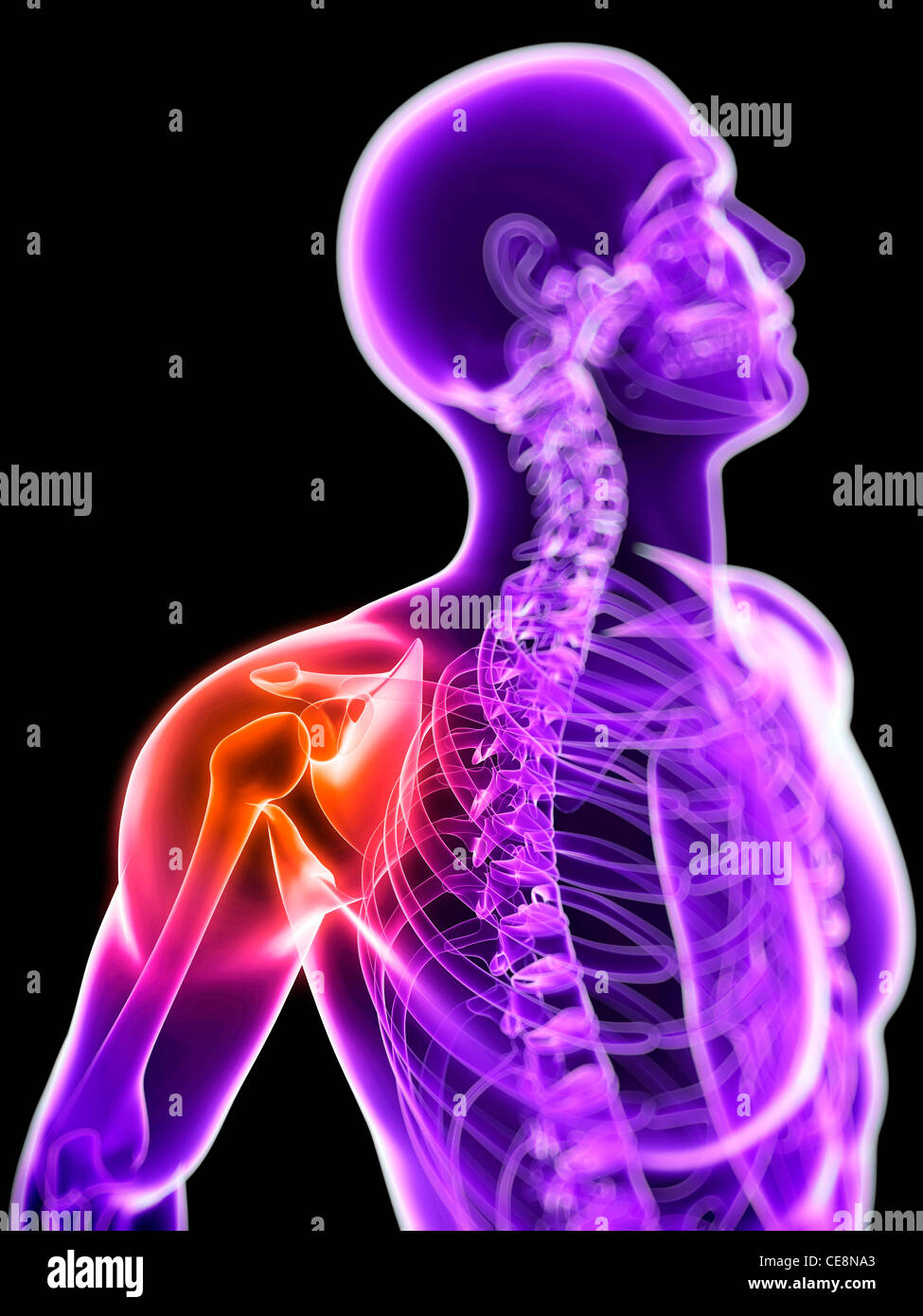 Shoulder pain, conceptual computer artwork Stock Photo - Alamy