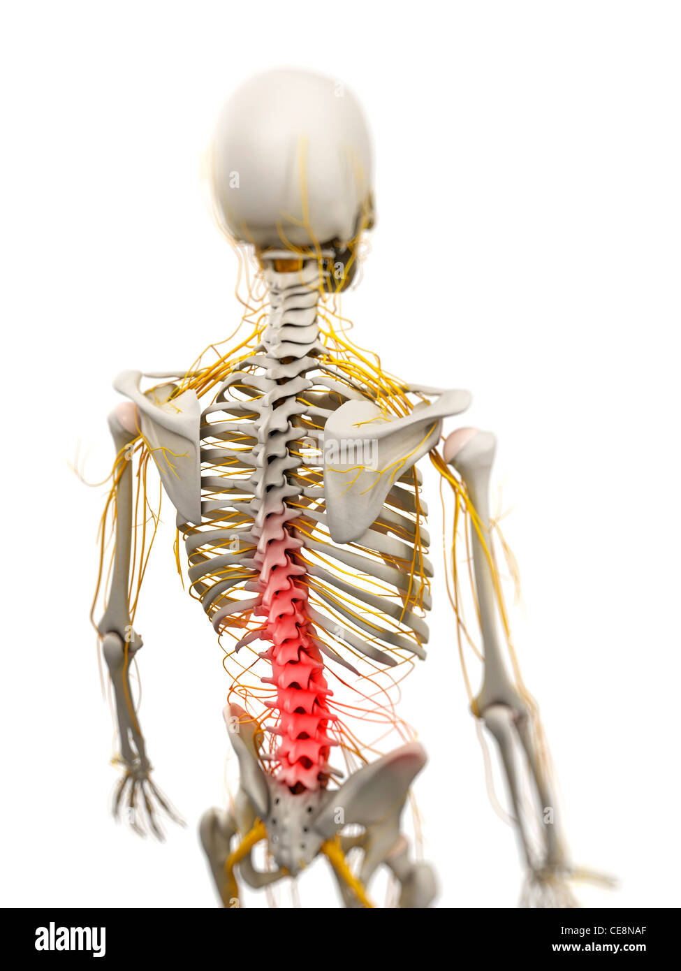 Back pain, conceptual computer artwork Stock Photo - Alamy