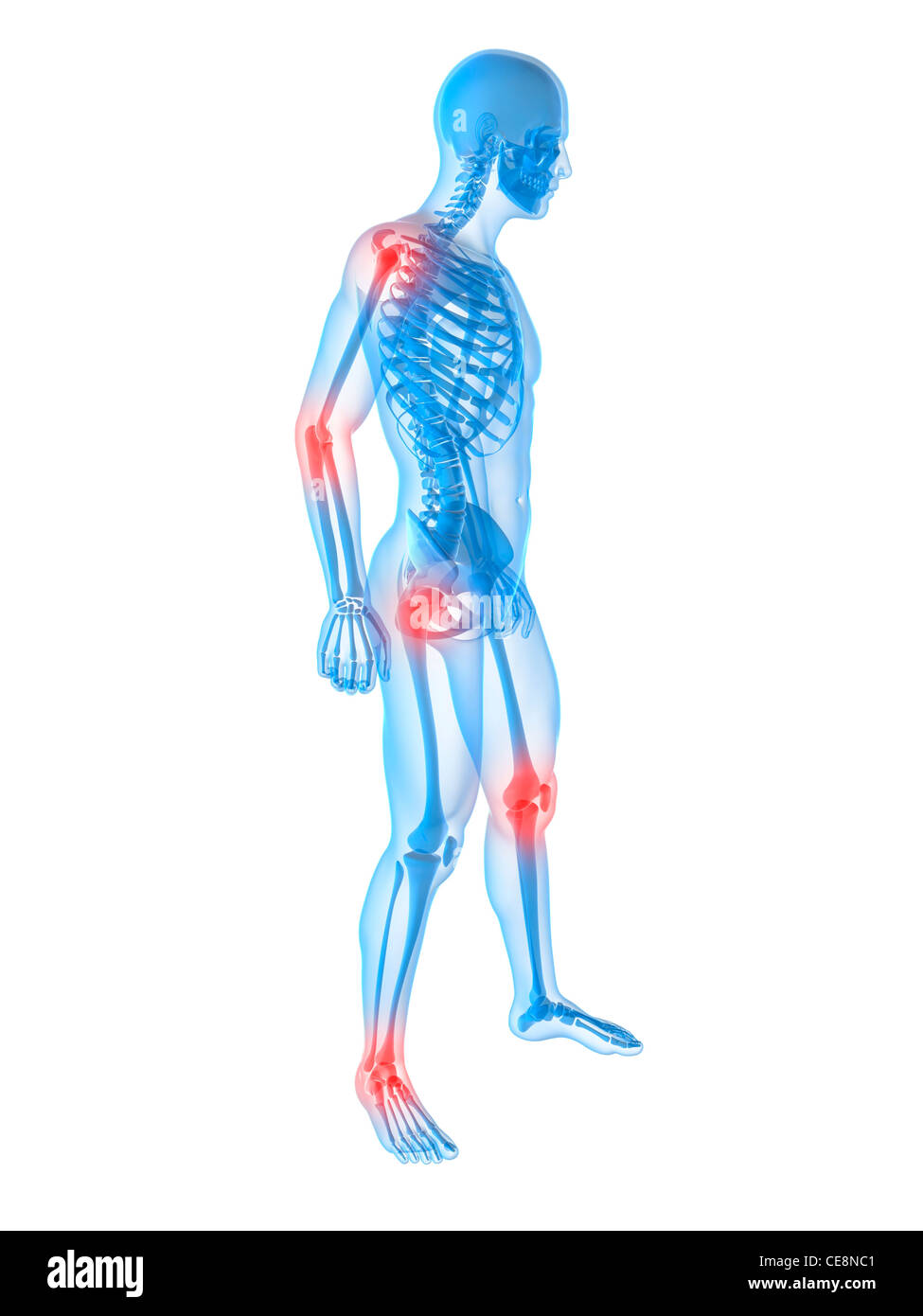 Joint pain, conceptual computer artwork Stock Photo - Alamy