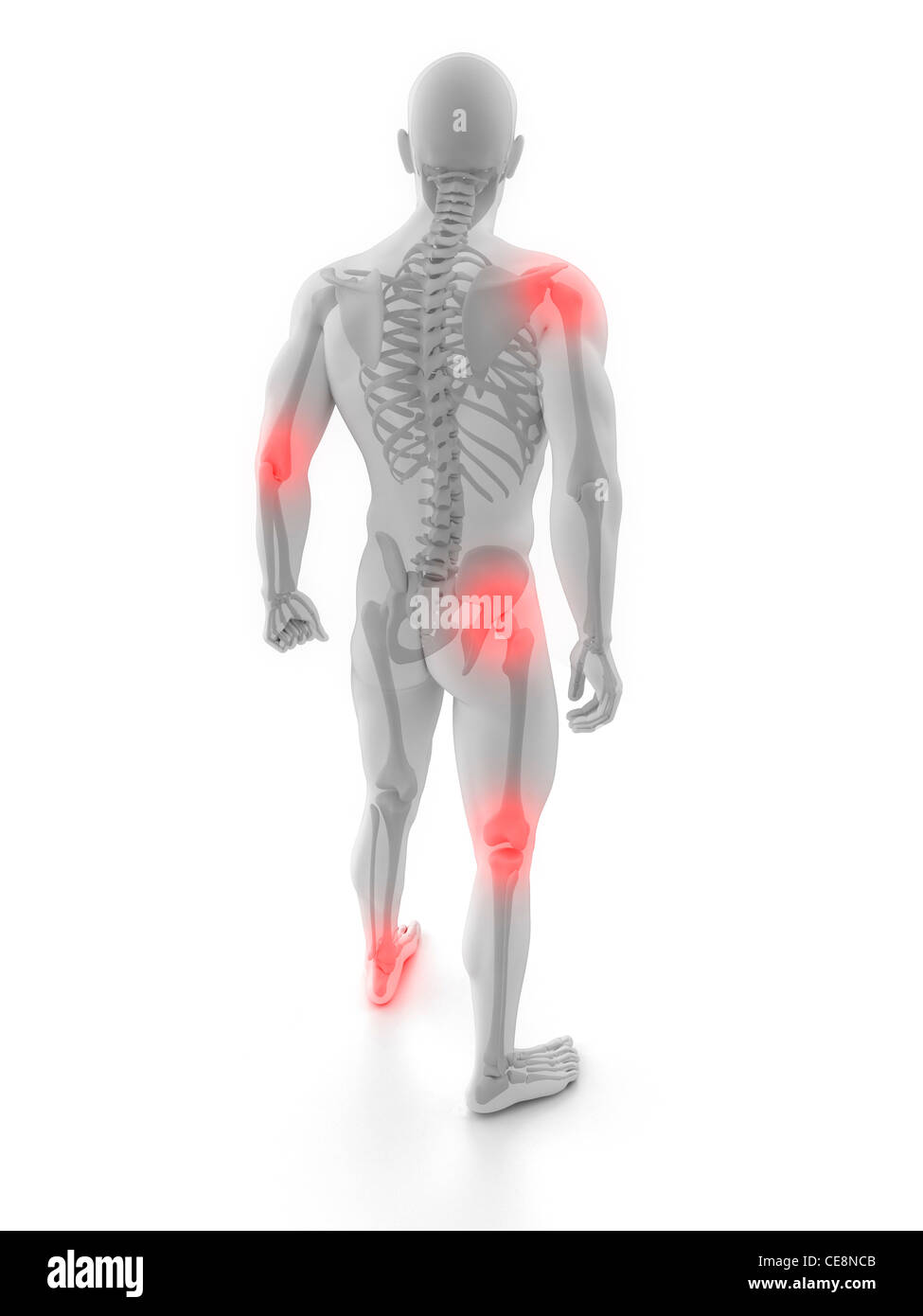 Joint pain, conceptual computer artwork Stock Photo - Alamy