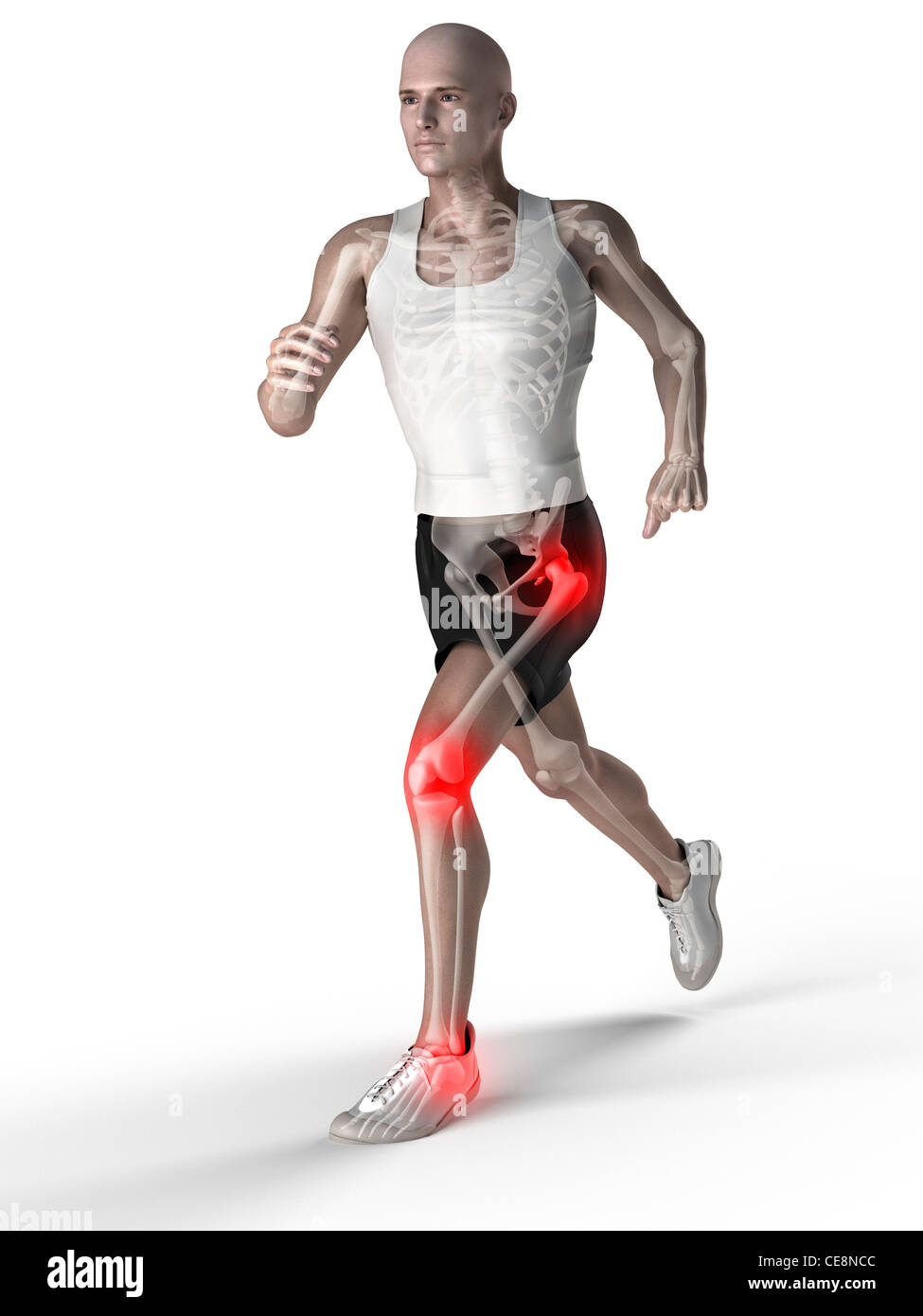 Joint pain, conceptual computer artwork Stock Photo - Alamy